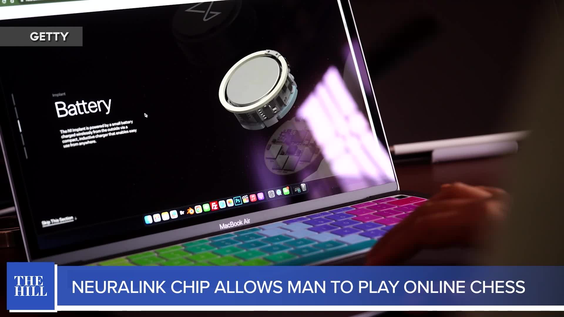 Neuralink chip allows paralyzed man to play online chess – The Daily ...