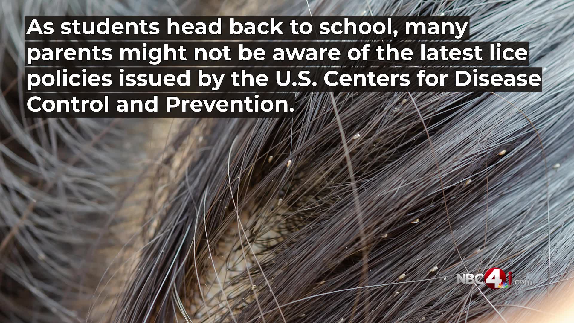 CDC guidelines: Students with lice no longer need to be sent home early ...